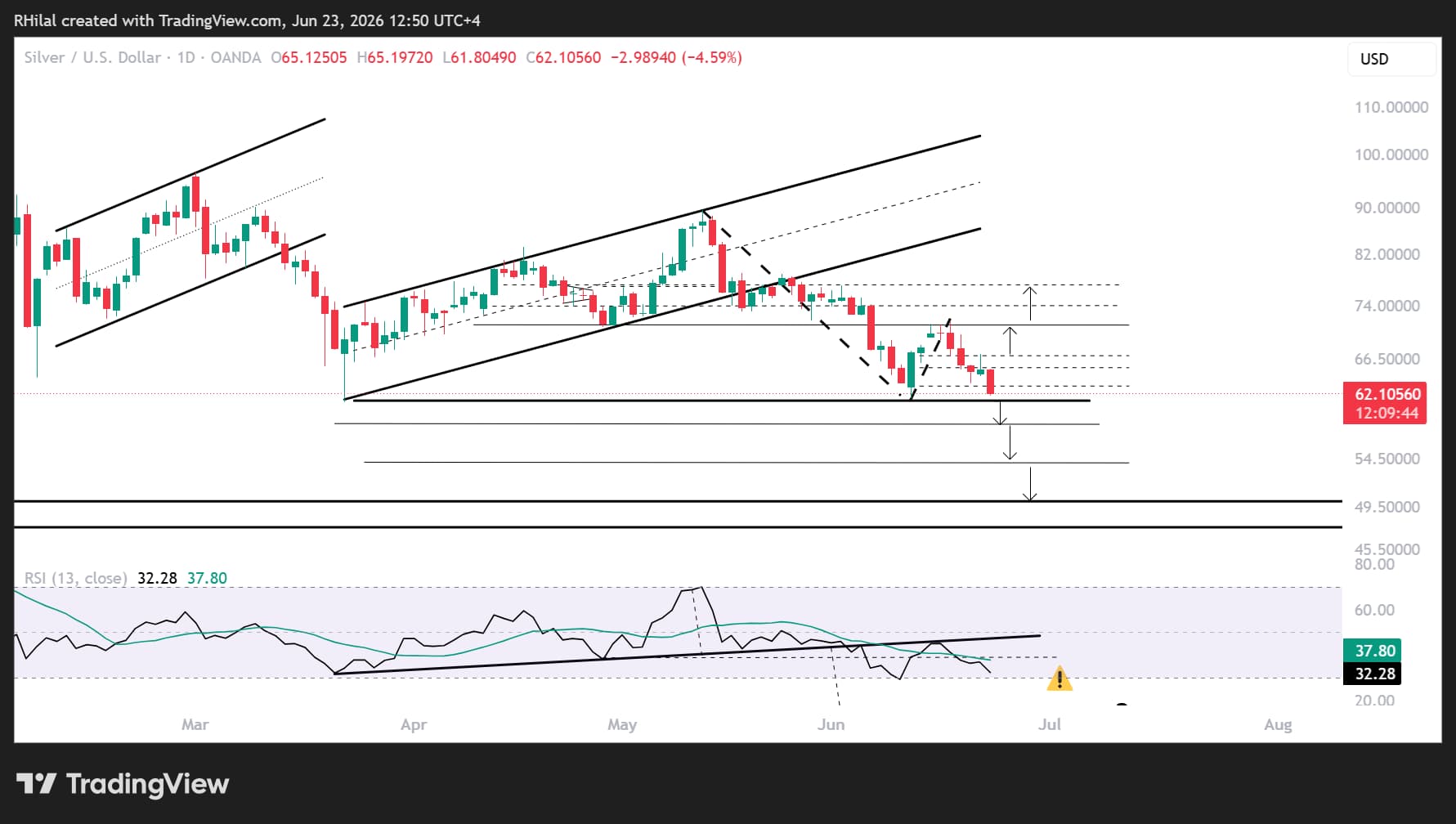 Gold and Silver Price Forecast: US Dollar Rally Threatens Fresh 2026 ...